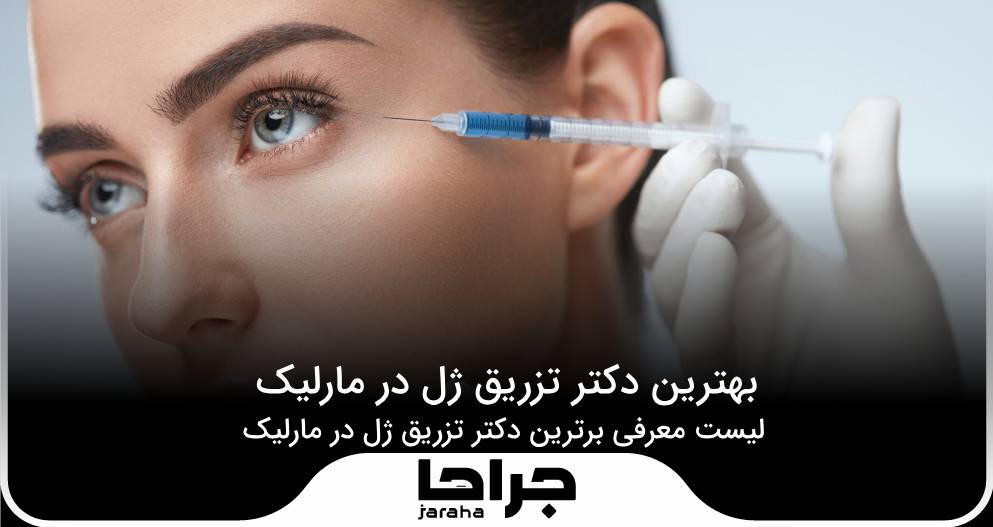 5 تا از بهترین دکتر تزریق ژل در مارلیک ️【سال1405】⭐+ آدرس و تلفن☎️
